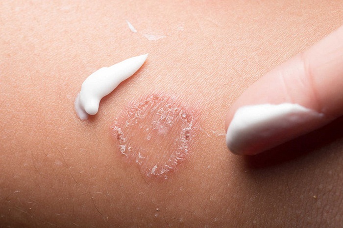 Kentax có tác dụng gì? Cách sử dụng thuốc hiệu quả