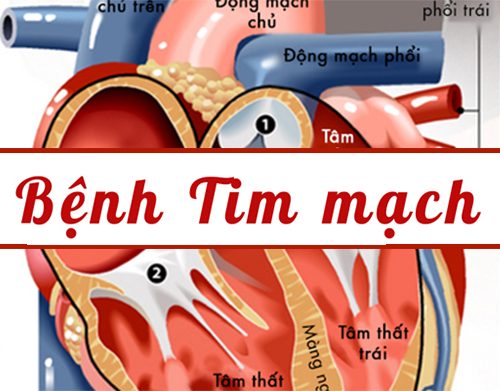 Bệnh tim là gì? Những triệu chứng nhận biết bệnh