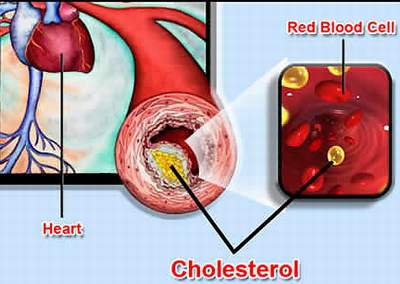 Cholesterol là gì? Giải pháp làm giảm lượng cholesterol